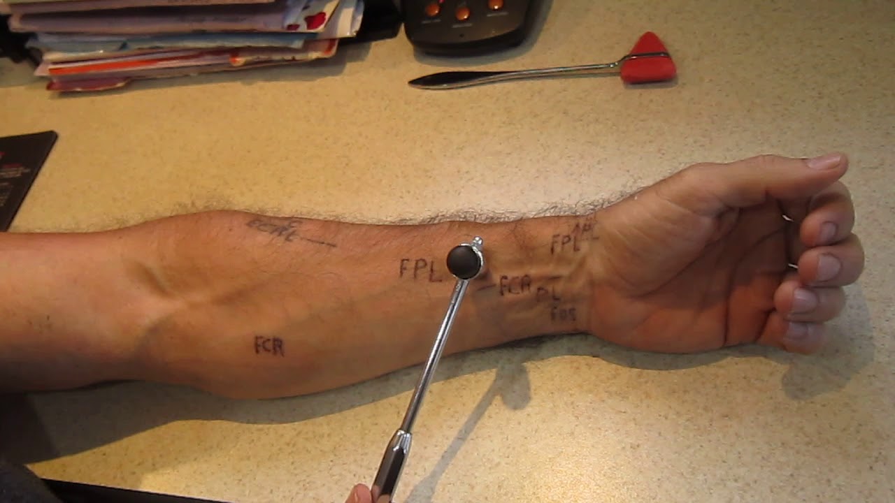 Flexor Pollicis Longus Reflex DTR MSR