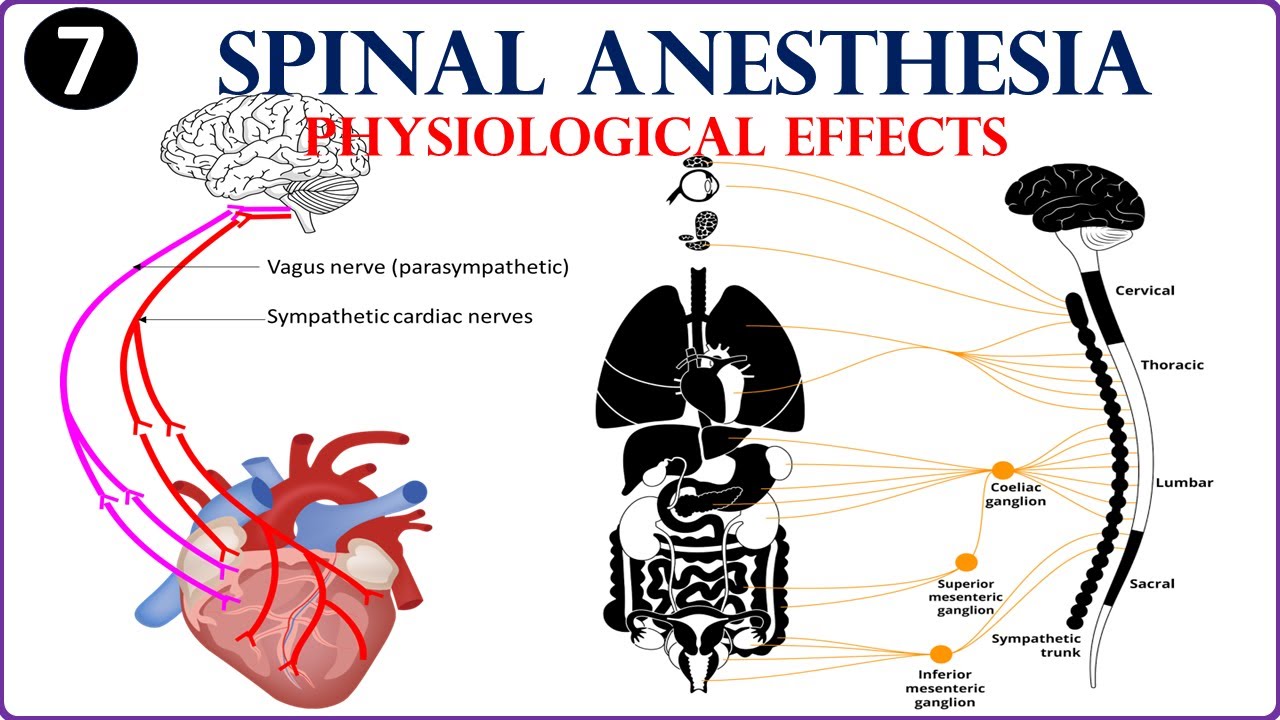 Spinal anesthesia | physiological effects