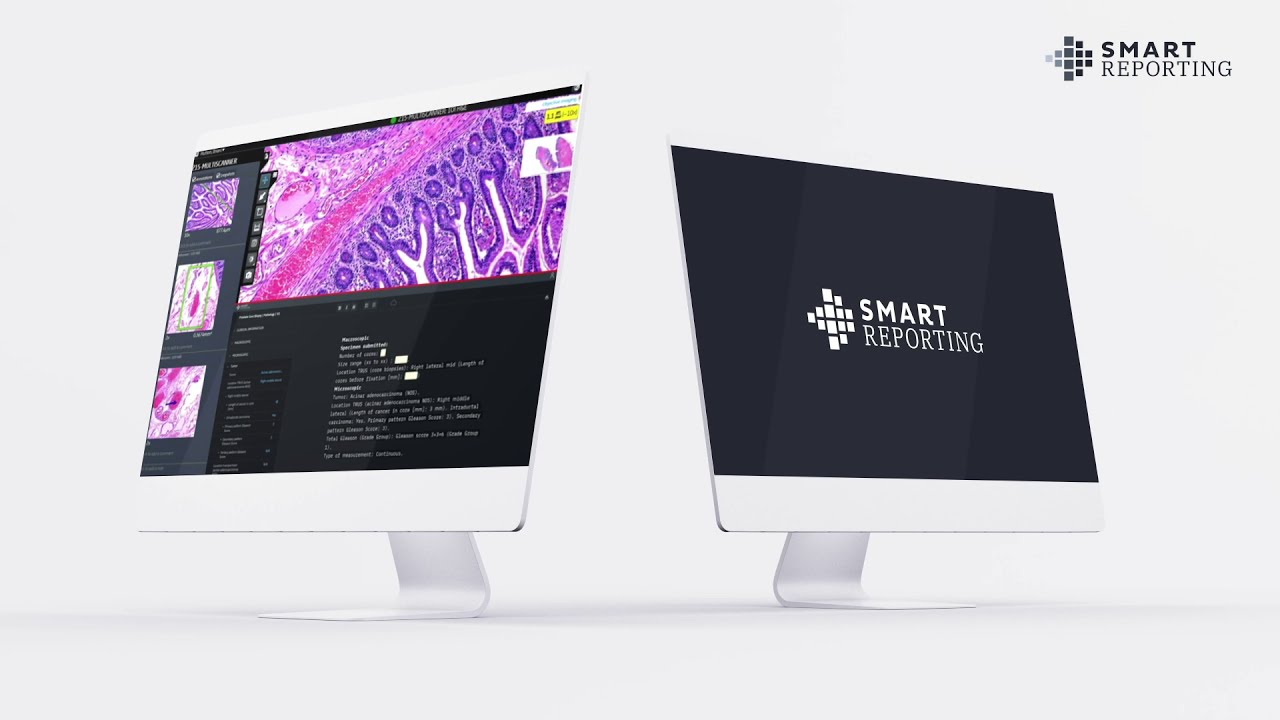 Structured reporting for pathology by Smart Reporting