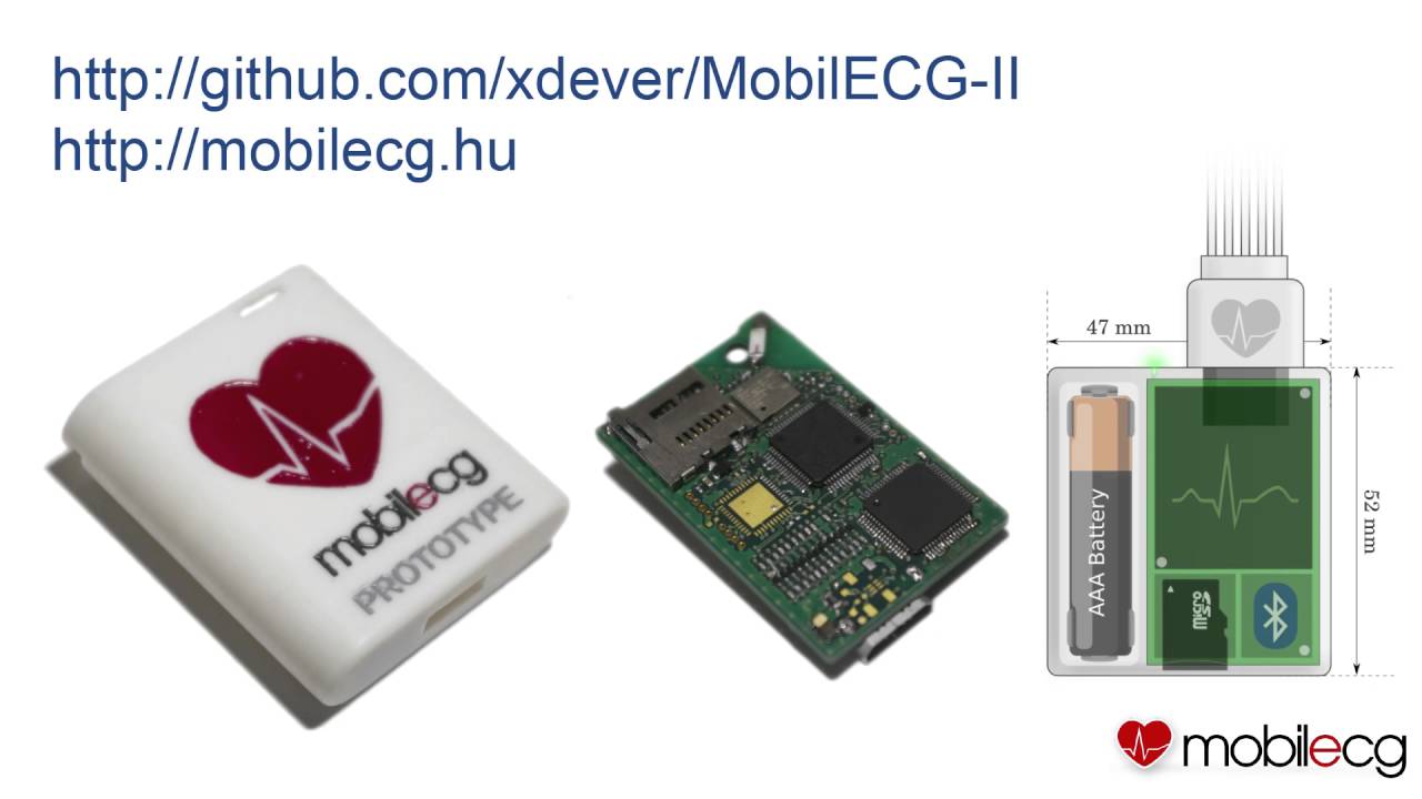 Saving Lives with Open-Source Electrocardiography