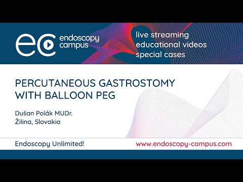 Percutaneous gastrostomy with balloon PEG