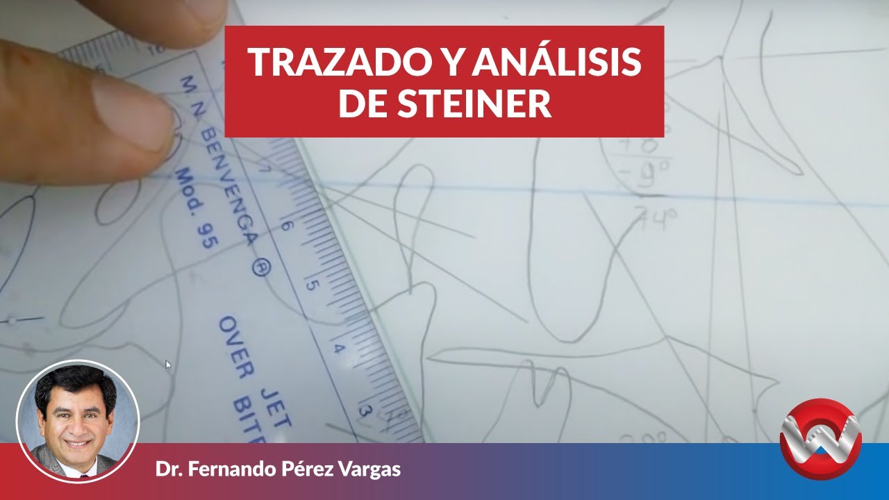 Steiner Layout and Analysis