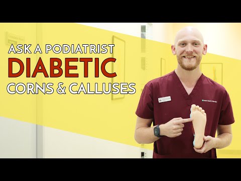 Diabetic Corns and Calluses - Senior Podiatrist Elliott Yeldham, East Coast Podiatry
