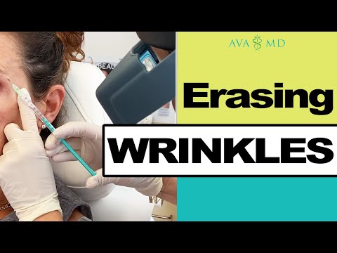 How To: Get Rid Of Fine Lines - Cosmetic Dermatology