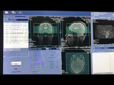 MRI MRA