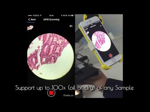 Smartphone Whole Slide Imaging(sWSI) Demo--Low Cost Slide Scanner.