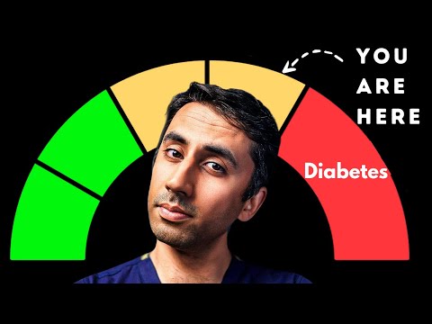 What is Pre-Diabetes and How To Reverse it Natrually (Doctor Explains)
