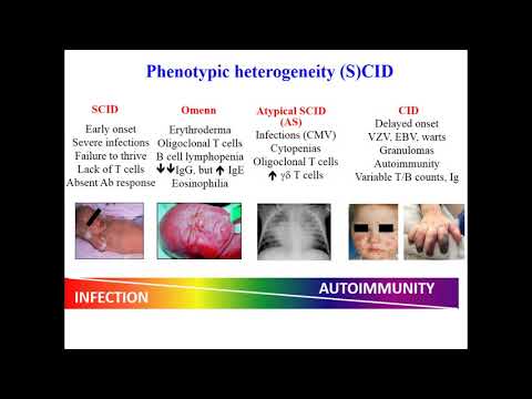 Managing Autoimmune Issues with SCID
