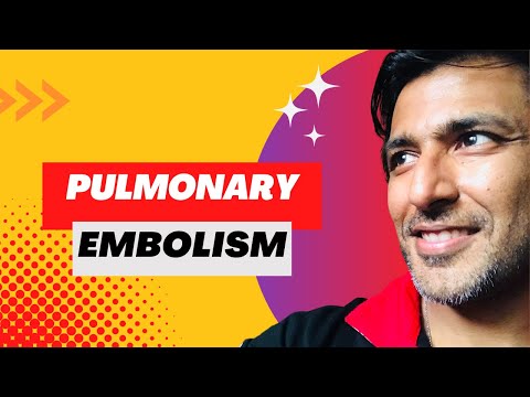 Pulmonary Embolism