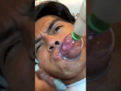 VENTOSA PRANK