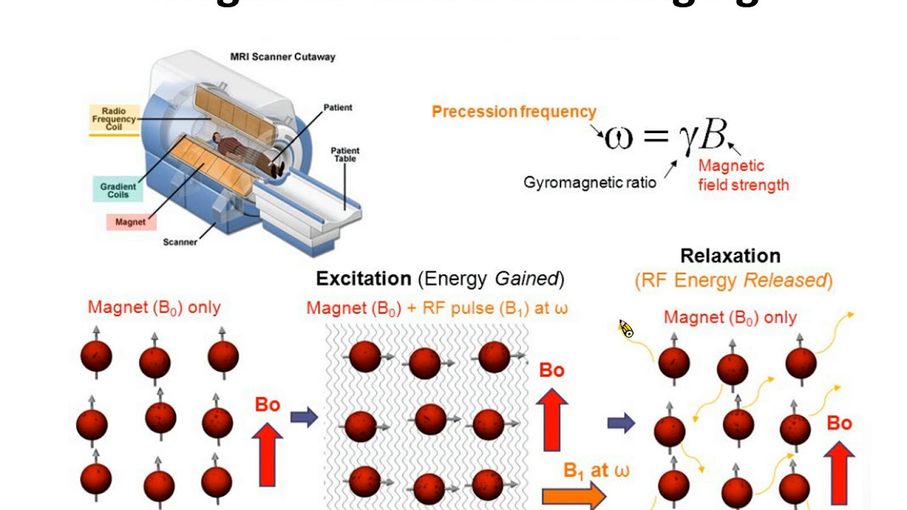 Class 5 Prediction of brain age using MRI data
