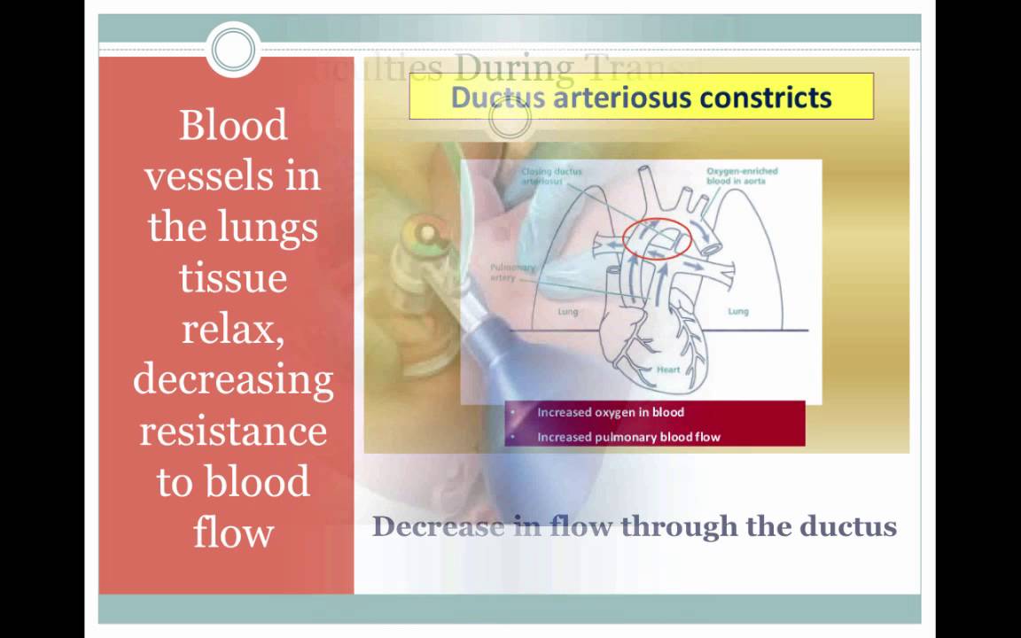 Neonatal Resuscitation Powerpoint Presentation