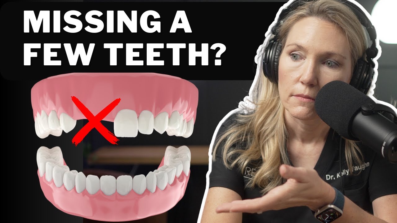 Top Tooth Replacement Solutions For Multiple Missing Teeth: Bridges Vs. Implants Vs. Partials