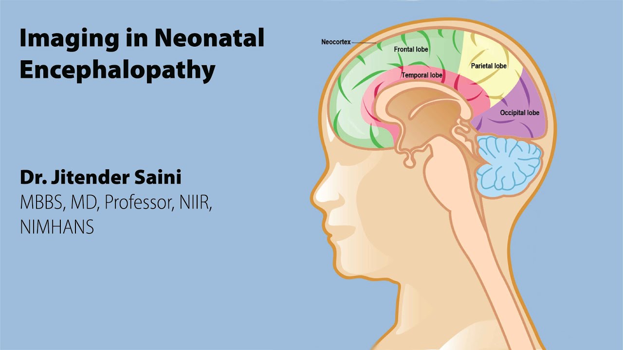 Imaging in Pediatric Epilepsy