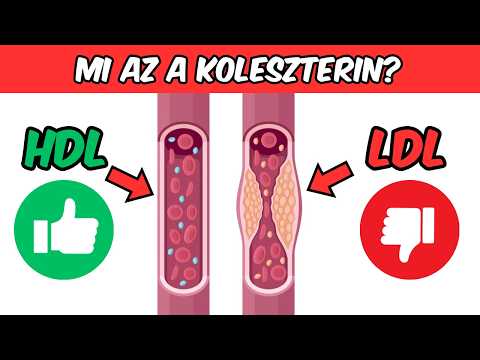 What Is Cholesterol? Overview & Types And Treatment