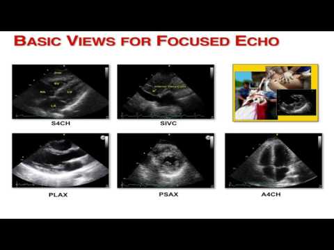 POCUS enhanced shock management (教學實況) – POCUS Academy