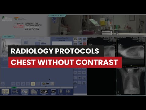 Computed Tomography Protocol Step-by-Step Guide: Chest CT Without Contrast