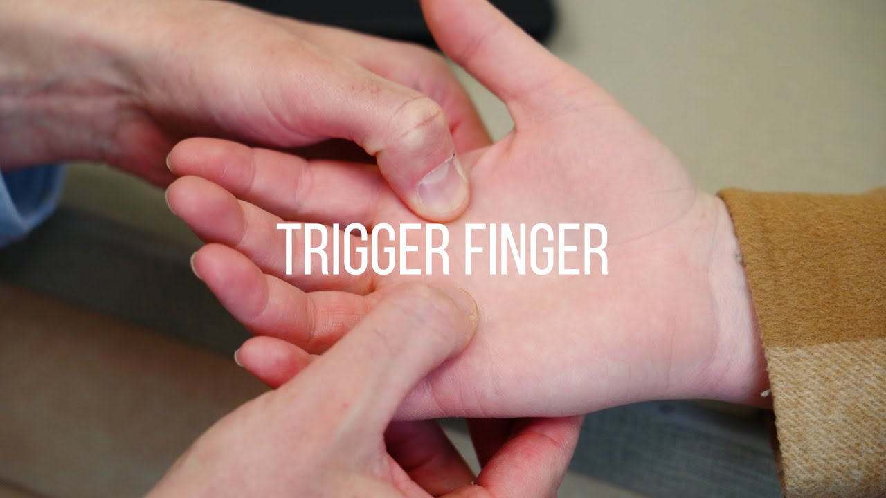 Trigger Finger Symptoms, Causes, and Treatment