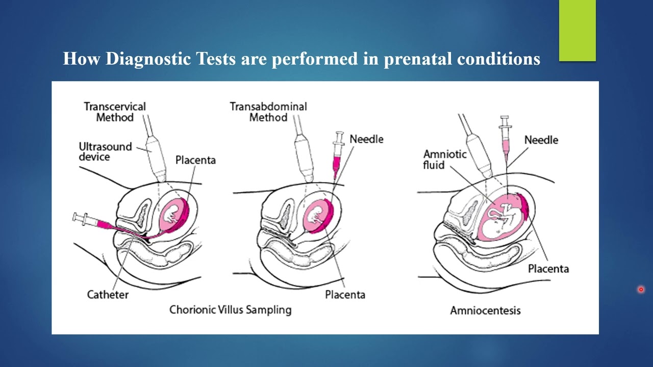 LECTURE 11 & 12 ppt with audio