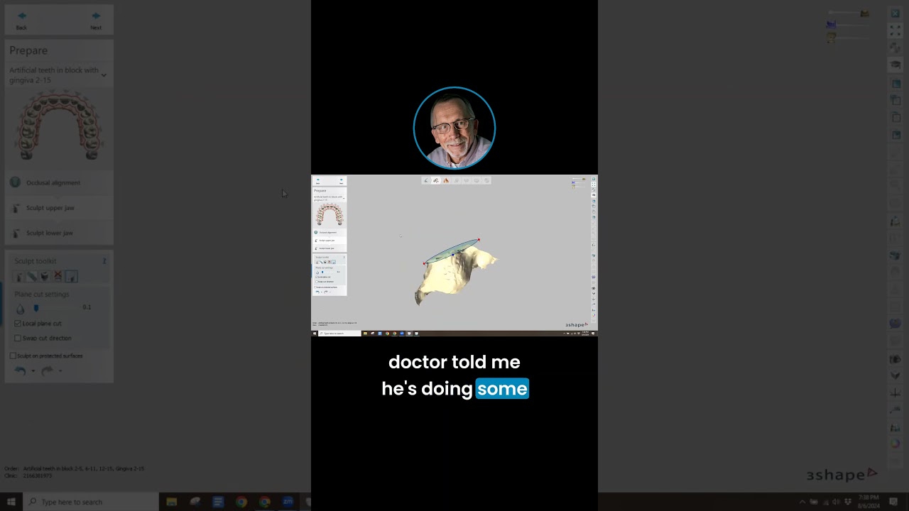 Digital tooth removal in 3Shape Denture Design with Jimmy Stegall CDT