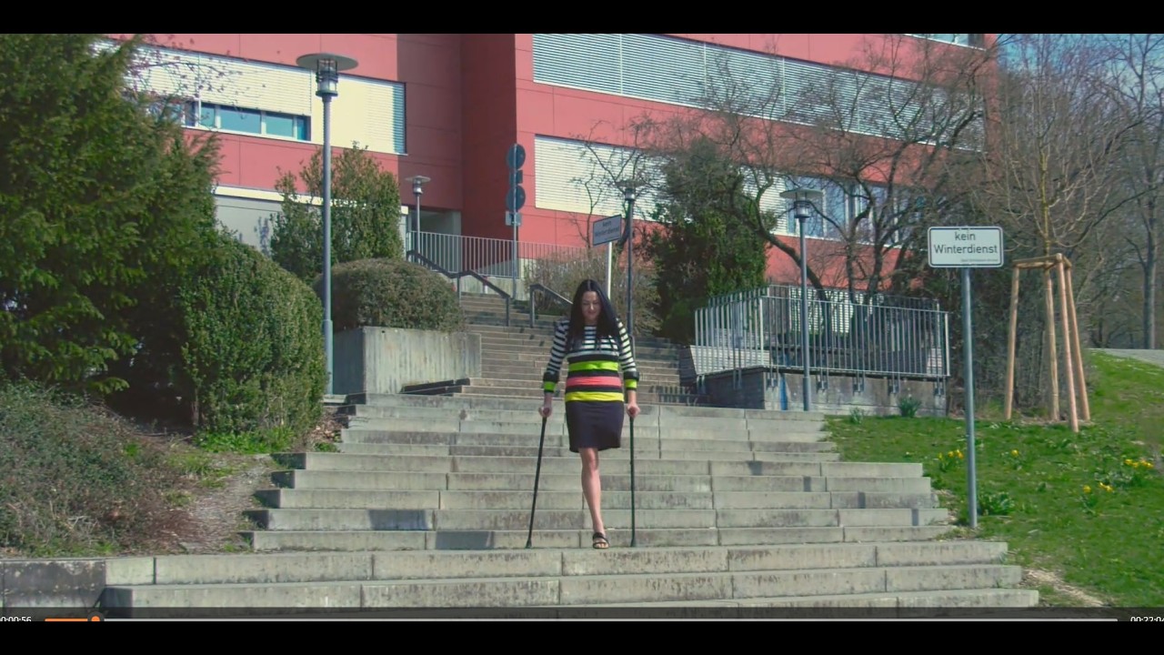 Leg amputee Natalie answers amputee questions preview