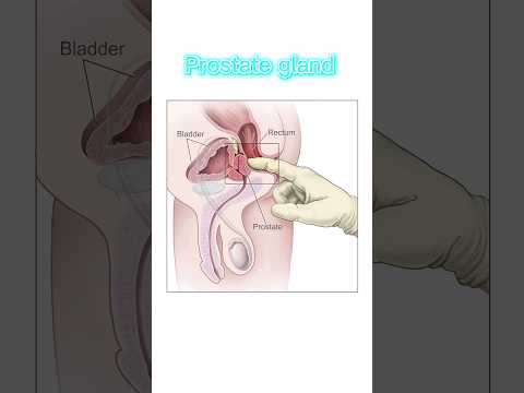PROSTATE GLAND - MEDICAL DEFINITION | Medical Consecutive Interpreting
