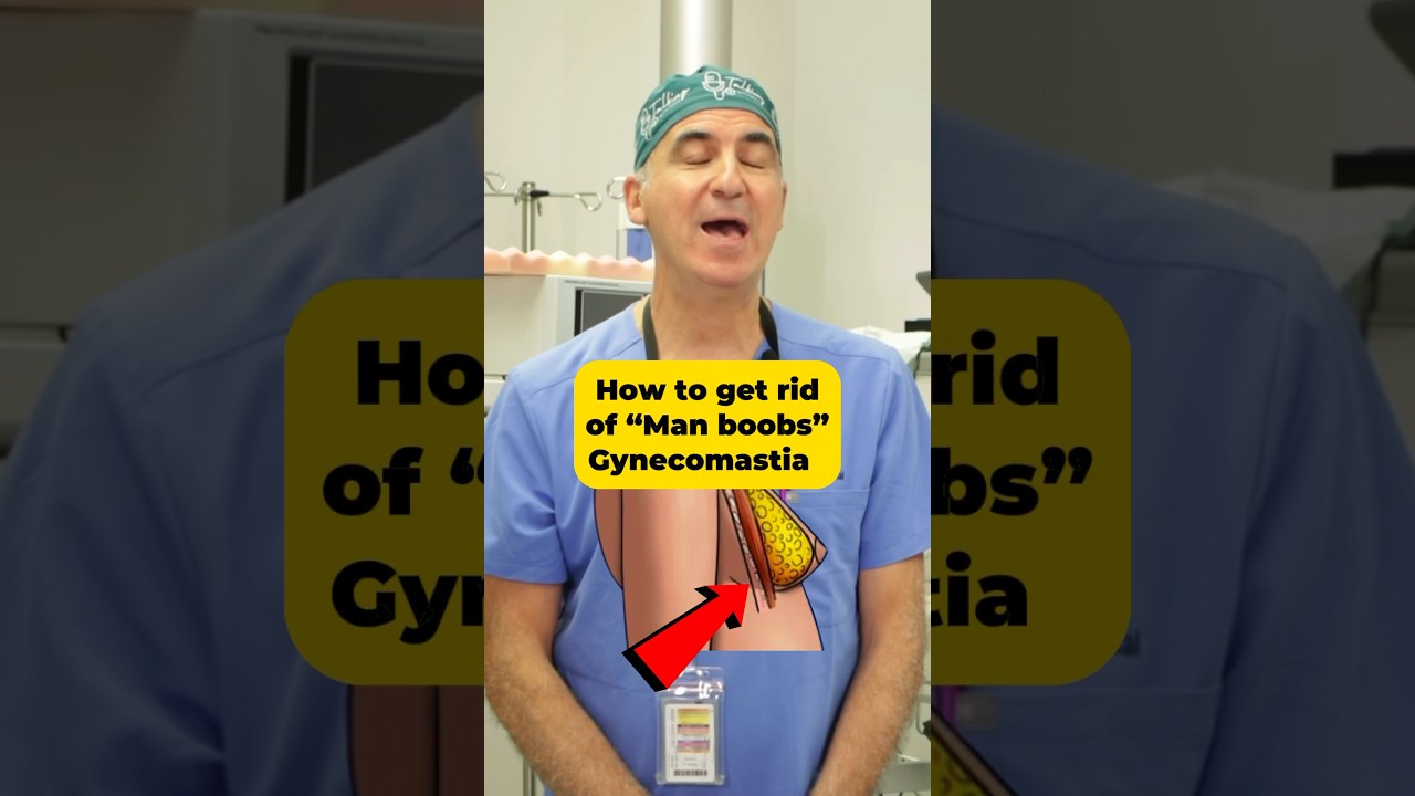 How to get rid of man boobs (Gynecomastia)