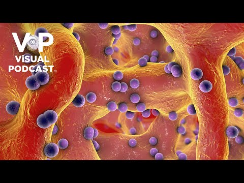 Osteomyelitis: Achieving Antibiotic Penetration