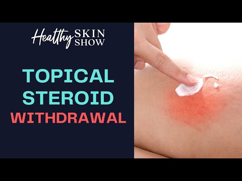 Topical Steroid WITHDRAWAL (A Personal Story) | Louise King