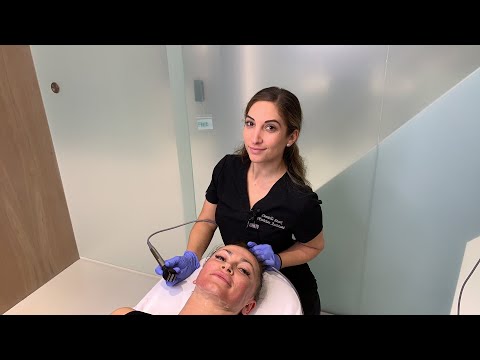 FORMA | Skin Tightening | Patient Commentary | West Hollywood, CA | Dr. Jason Emer