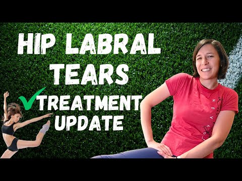 Hip Labral Tears | Everything to Know + Research