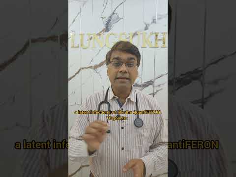 What is Mantoux test? | Latent TB | Quantiferon TB Gold test | TB gold | LTBI | Dr.Ankush