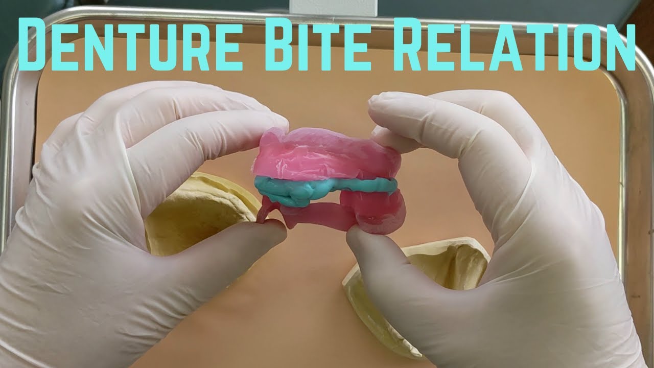 Bite Registration for a denture