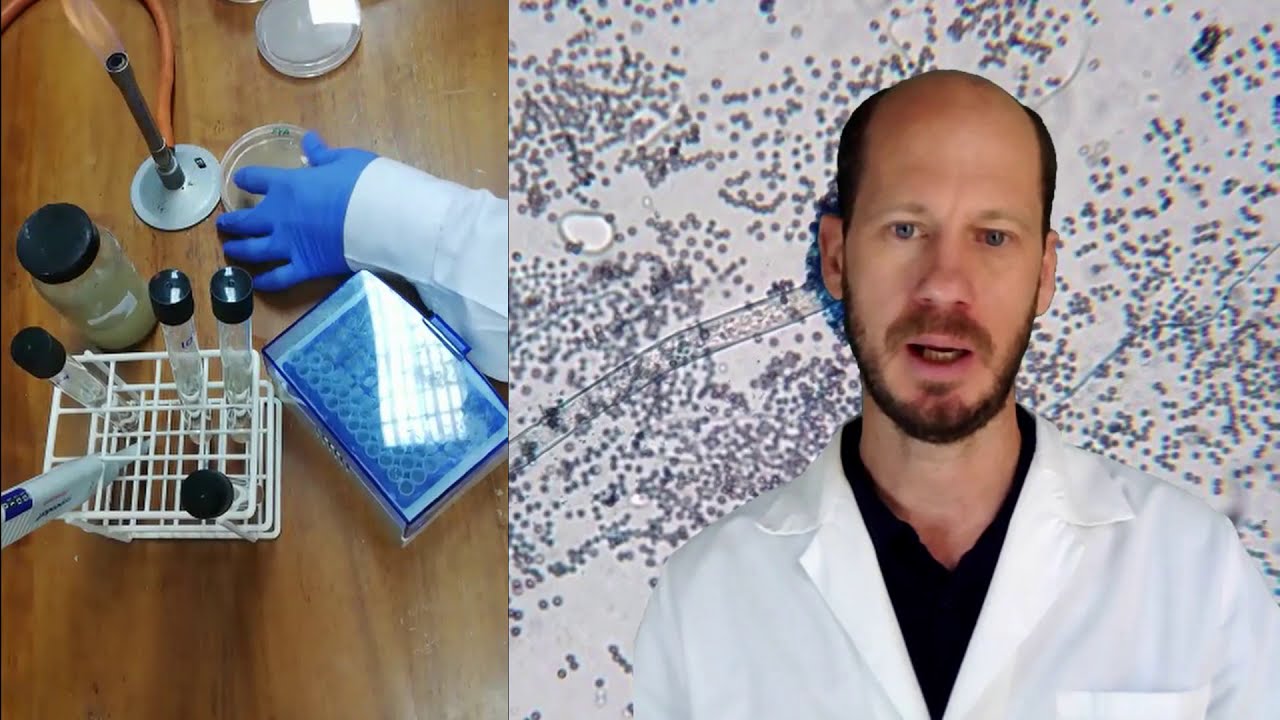lab 03 - Enumeration of soil microbes in agar plates