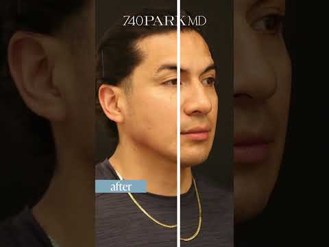 Definition in the face is such a simple way to enhance your natural features ????