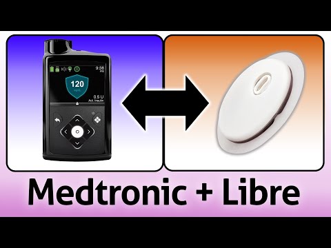 Medtronic's New CGM Powered by Libre - Explained