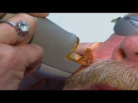 An end to rosacea?