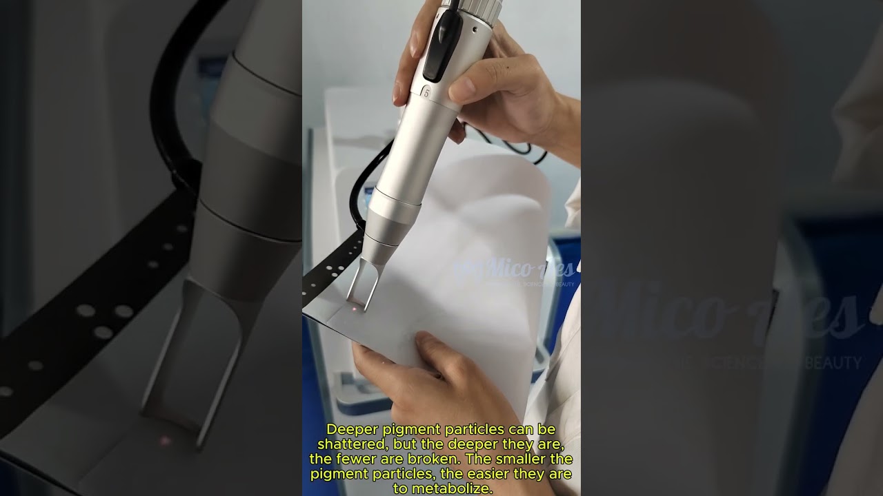 Pico Laser Training | 3 Types of Pigmentation Removal – Freckles, Melasma&Deep Spots Treatment Guide