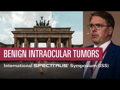 Imaging of Benign Intraocular Tumors – Heinrich Heimann | ISS 2023