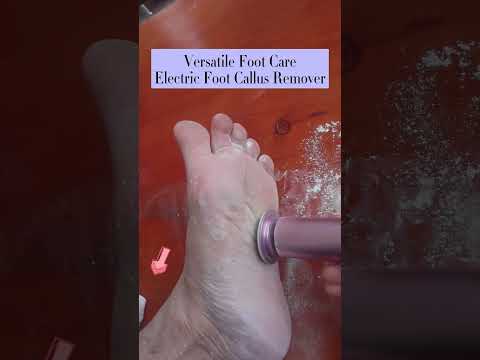 Versatile Electric Foot File for Callus Removal! #fok #footcare