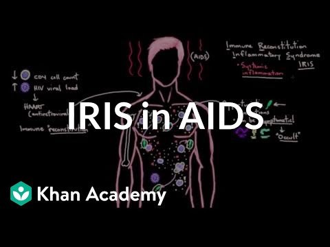 Immune reconstitution inflammatory syndrome (IRIS) in AIDS | NCLEX-RN | Khan Academy