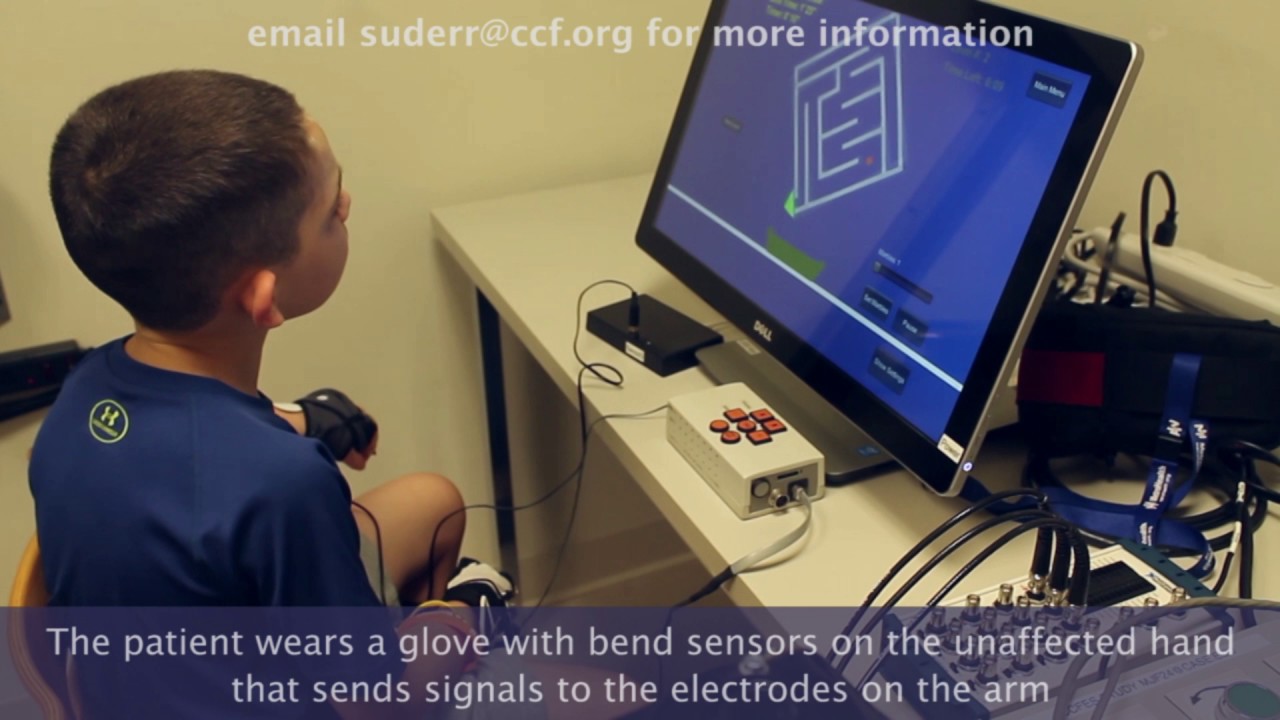 CCFES Video Game Therapy for Cerebral Palsy, Pediatric Hand Grasp