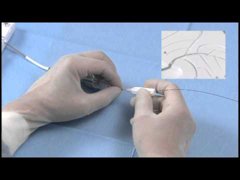 Guide Wire - Medical Guide Wire Latest Price, Manufacturers & Suppliers