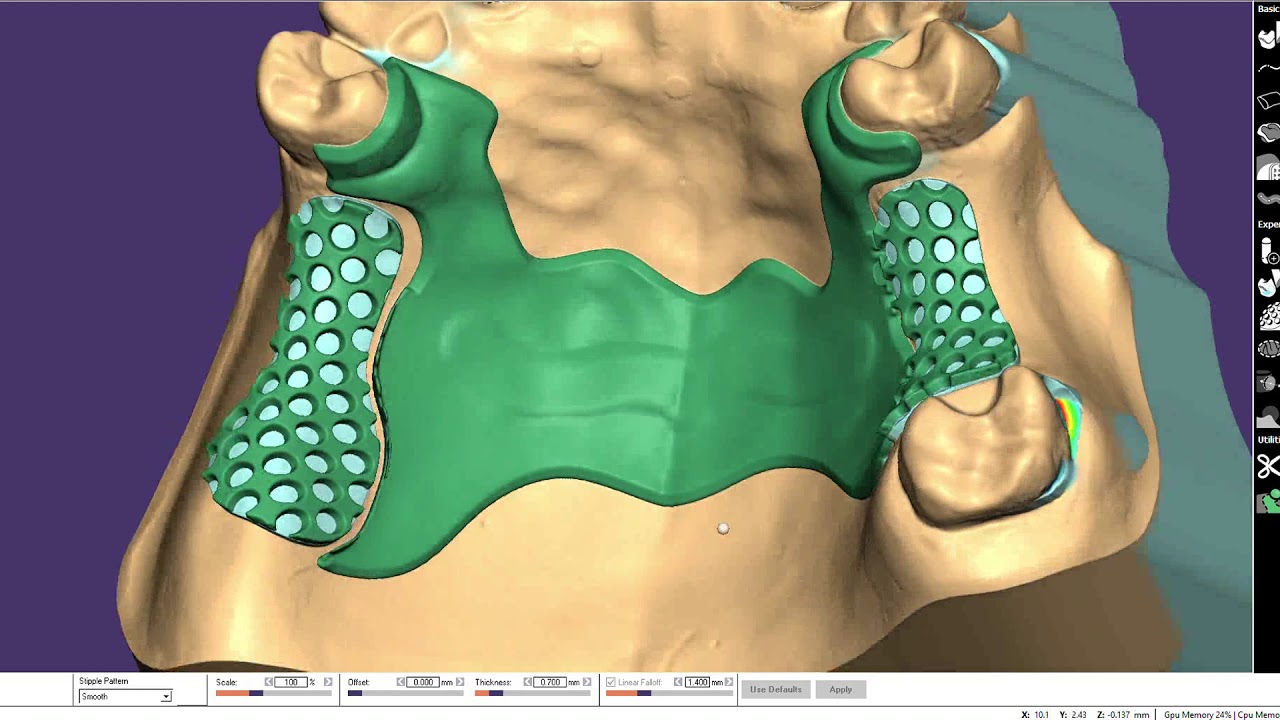 EXOCAD PARTIALCAD - PPR DIGITAL