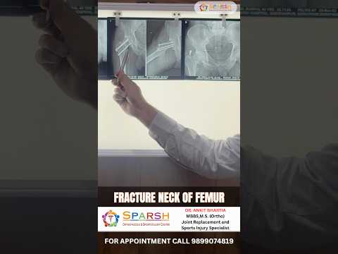 #fractureneckoffemur