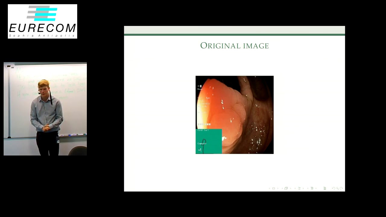 Using Preprocessing as a Tool in Medical Image Detection