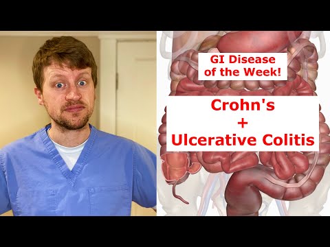 Inflammatory Bowel Disease (Crohn’s and Ulcerative Colitis) in 90 Seconds