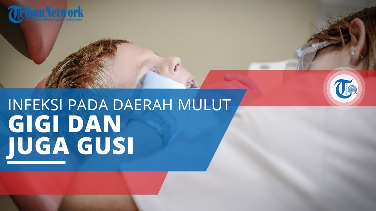 Abses Gigi, Infeksi Bakteri yang Menyebabkan Adanya Penumpukan Nanah di ...