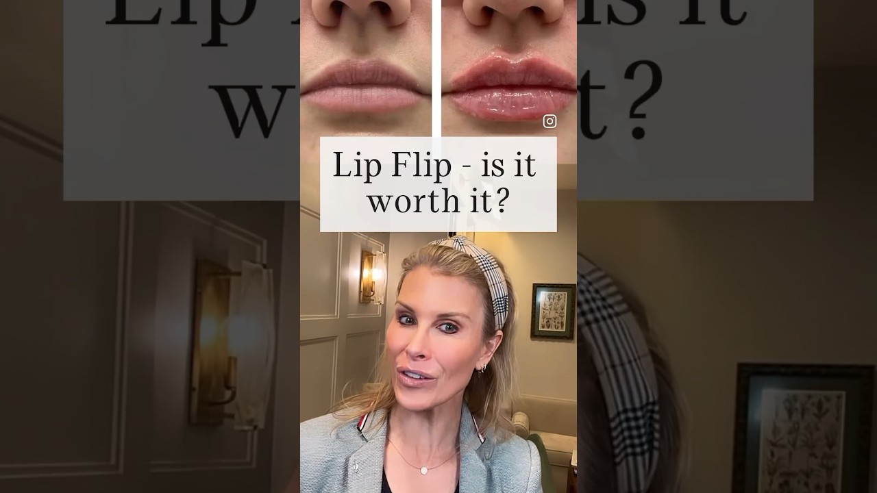 Is a Lip Flip worth it? #botox #beauty #filler