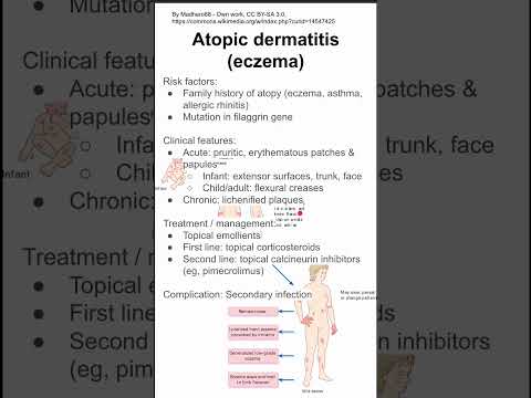 Atopic dermatitis (eczema)
